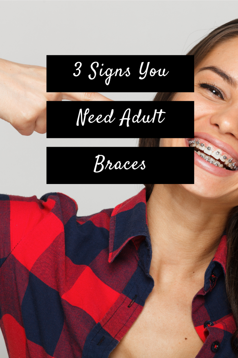 3 Signs You Need Adult Braces – Moments With Mandi